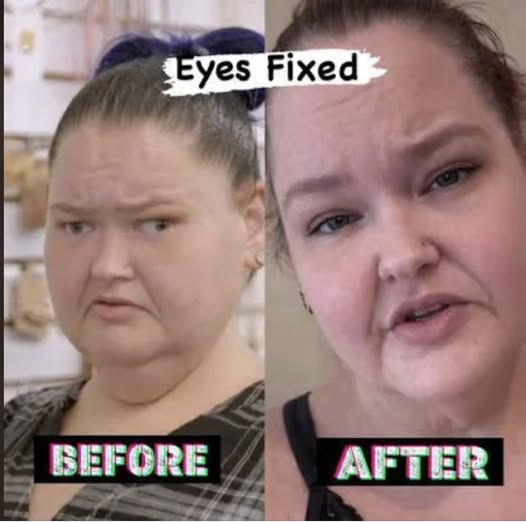 AMY LOOK DIFFERENT” — Amy Slaton Reveals Shocking Eye Surgery Results ...